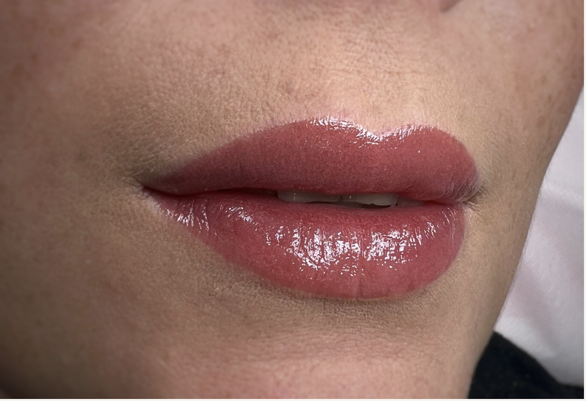Dark Lip Correction, Neutralization, and Lip Blushing: Key Differences ...